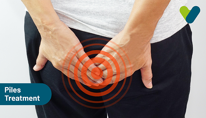 Piles Treatment: Effective Options for Hemorrhoids Treatment | LivLong